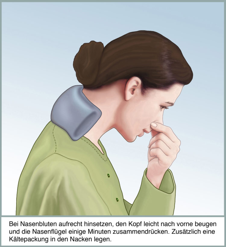 Nasenbluten – Ursachen, Therapie und Symptome – Heilpraxis