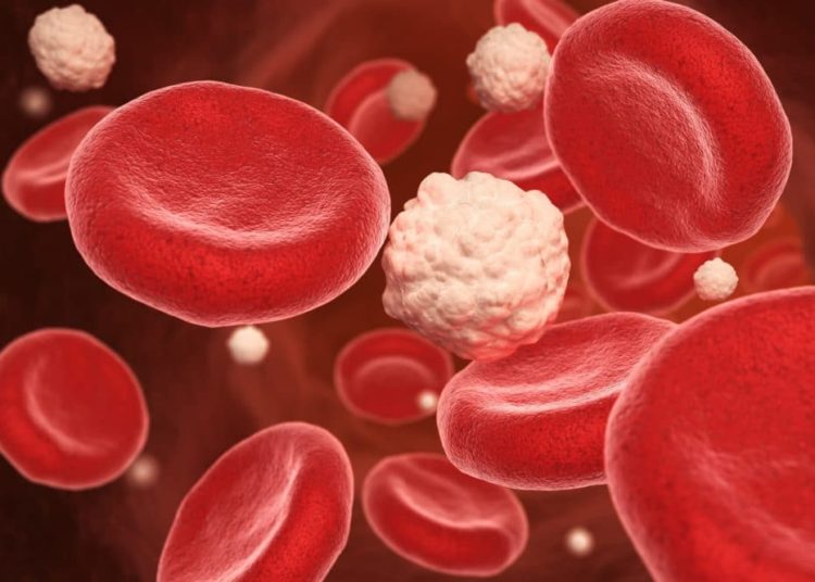 Armschmerzen: Ursachen und Therapie – Heilpraxis