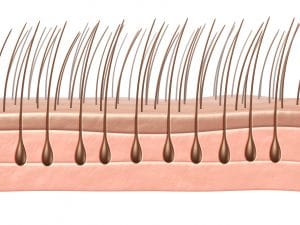 Haarwurzelentzündung: Symptome, Ursachen und Behandlung – Heilpraxis