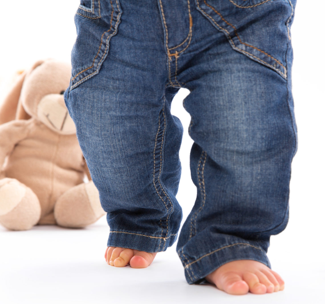 O-Beine – Ursachen und Behandlung – Heilpraxis