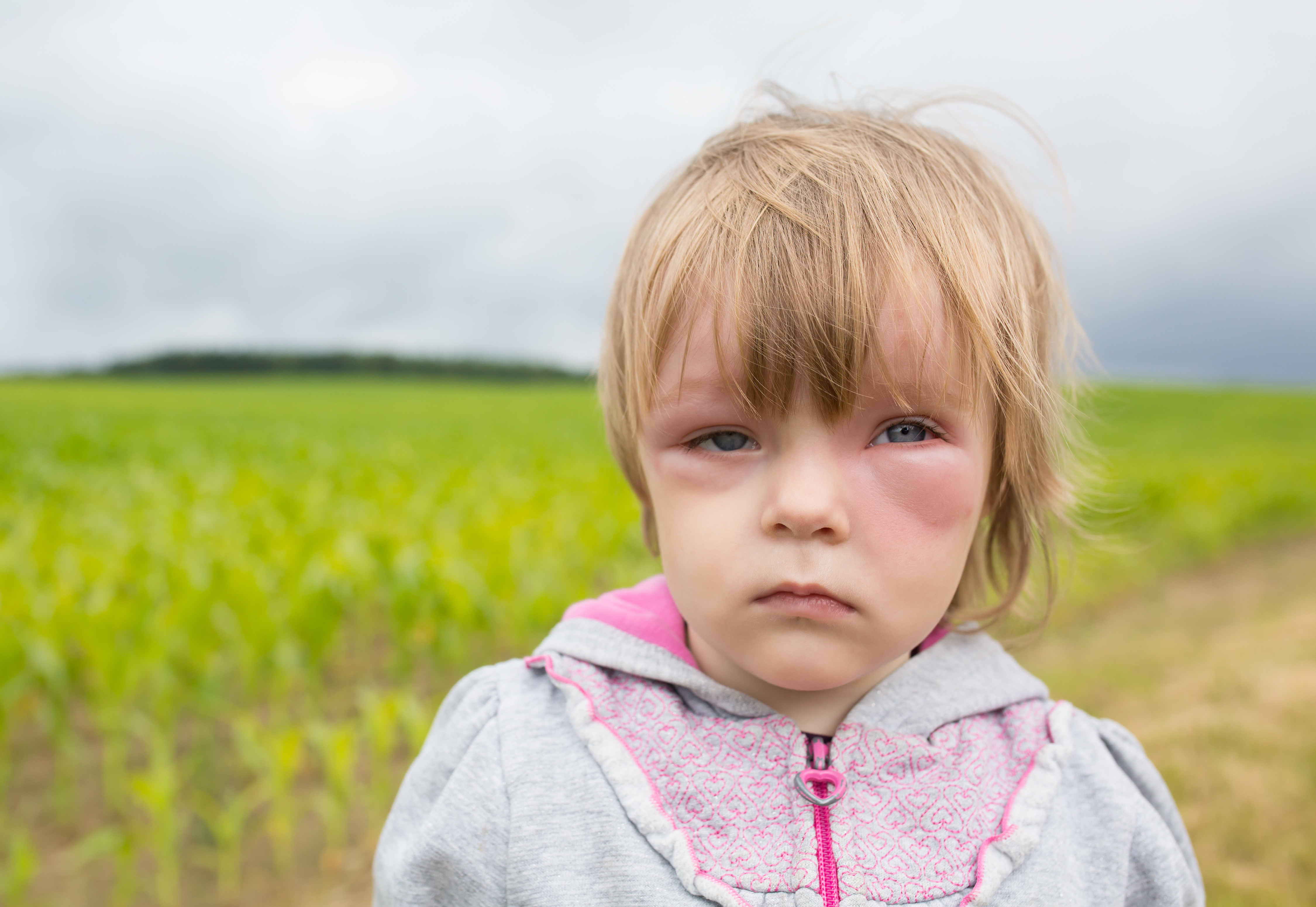 Kinder: Häufige Infekte deuten auf Allergien – Heilpraxis Kinder: Häufige Infekte deuten auf Allergien – Heilpraxis