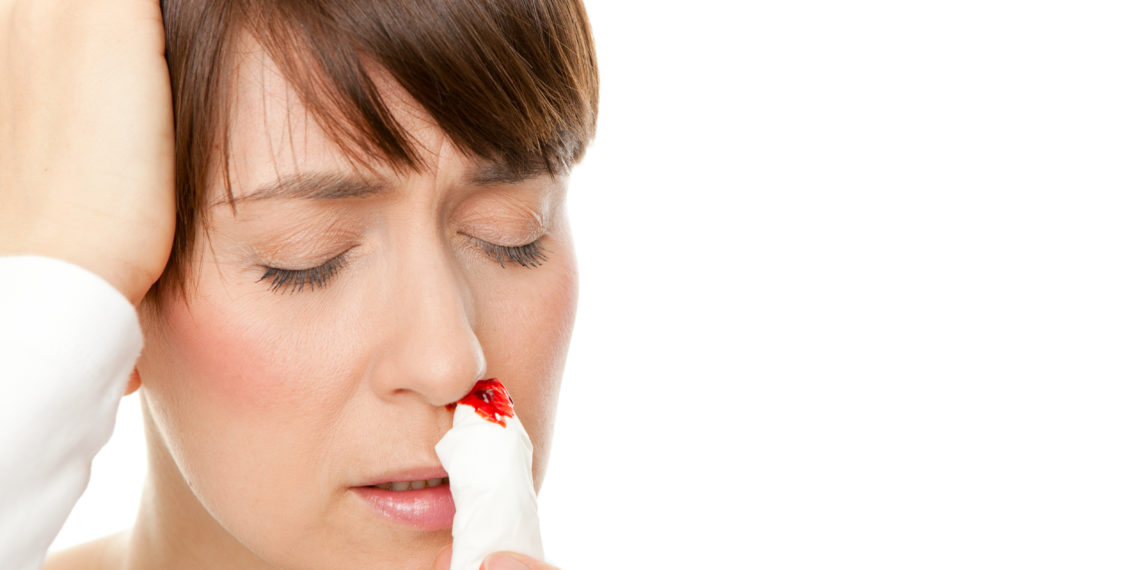 Häufiges Nasenbluten – Ursachen, Therapie und Symptome – Heilpraxis