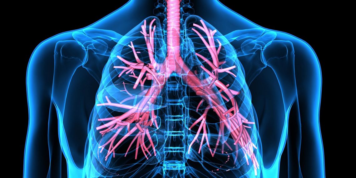 Asthma bronchiale – Ursachen, Symptome und Therapie – Heilpraxis