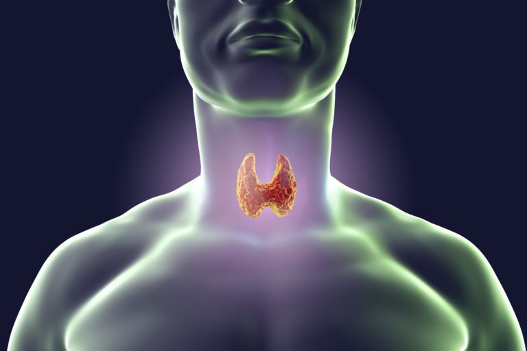 Jodunverträglichkeit – Symptome, Ursachen und Behandlung – Heilpraxis