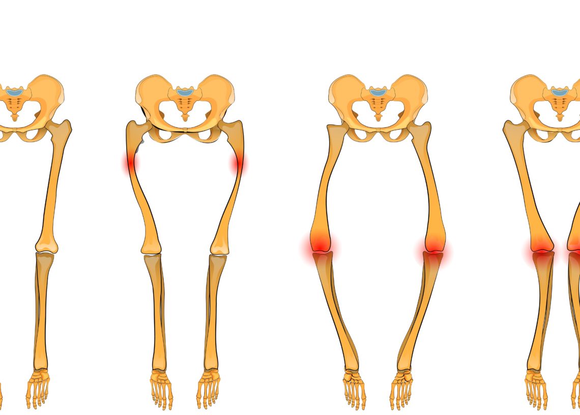 Krankheiten – Seite 8 – Heilpraxis