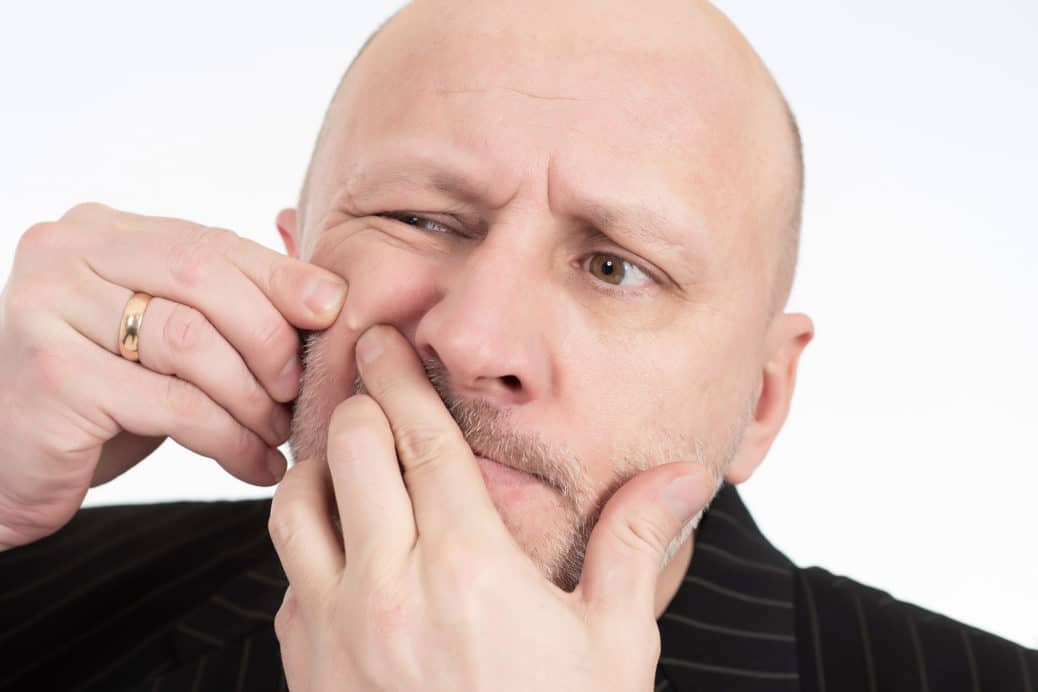 Furunkulose – Symptome, Diagnose und Therapie – Heilpraxis