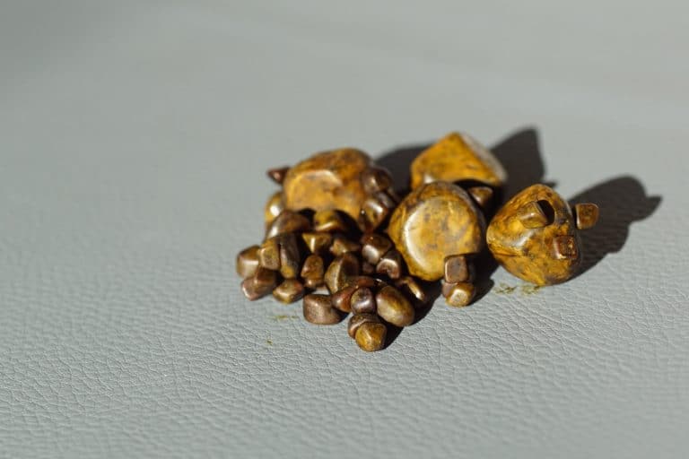 Entschlüsselt: So entstehen Gallensteine und Harnsteine – Heilpraxis