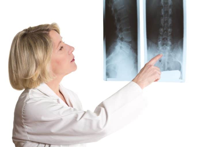 Spondylarthrose – Symptome, Ursachen und Behandlung – Heilpraxis