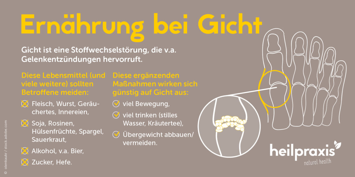 Ernährung bei Gicht – Heilpraxis