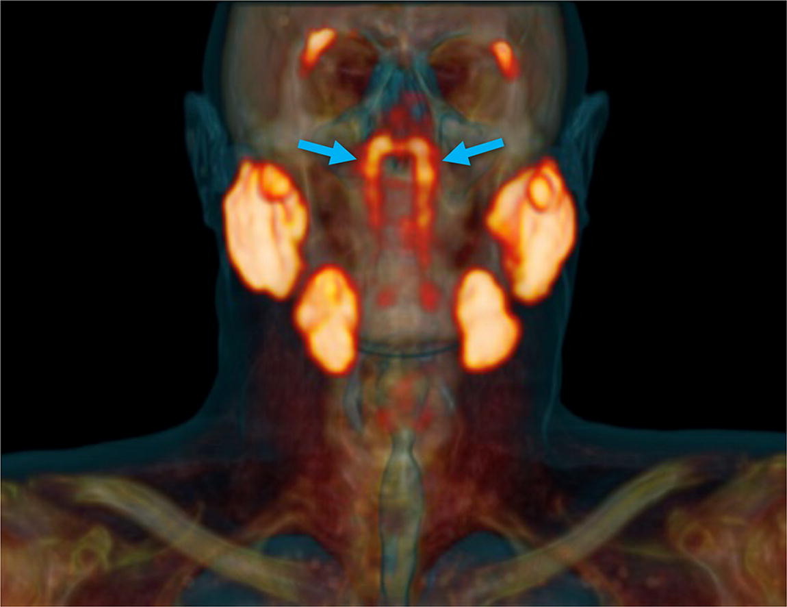 Forscher finden neues Organ im Nasenrachenraum – Heilpraxis