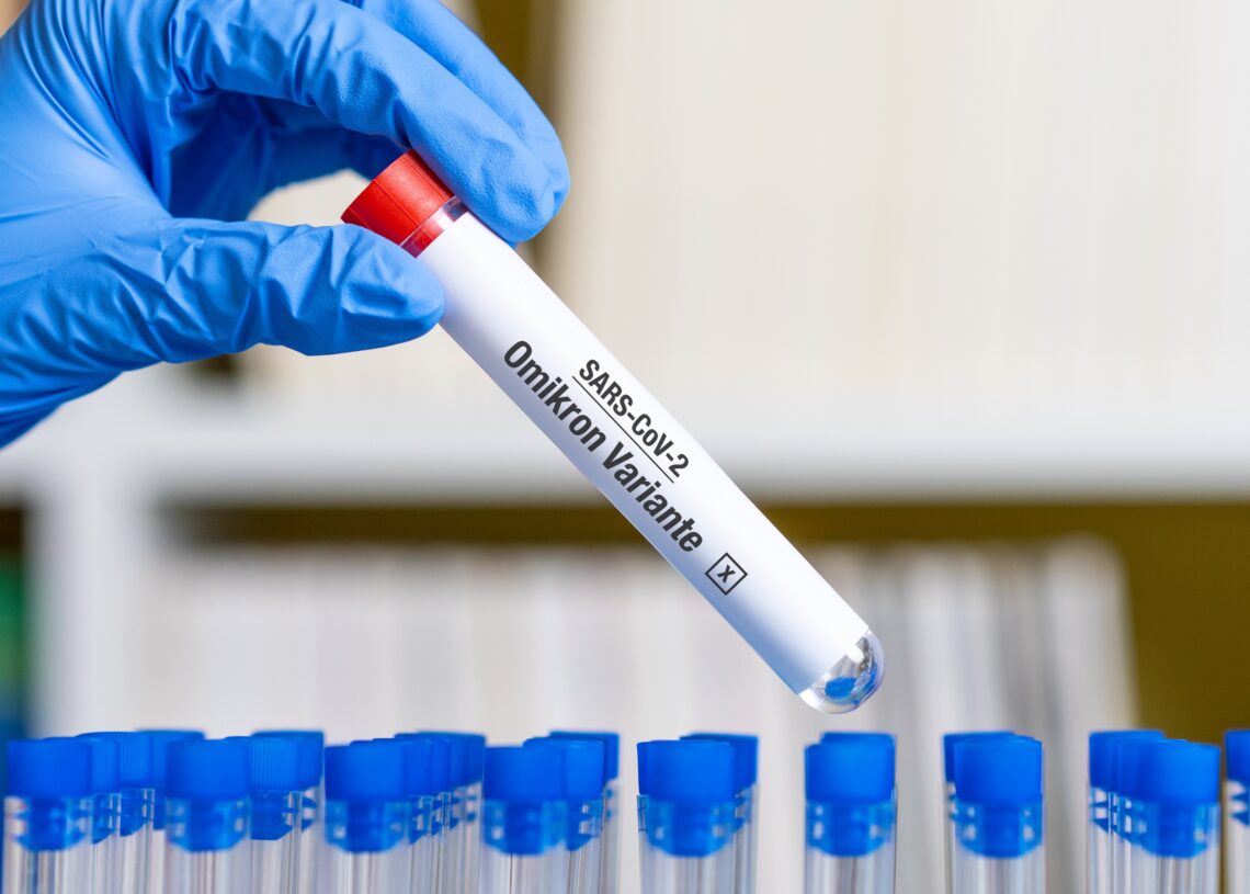 Armschmerzen: Ursachen und Therapie – Heilpraxis