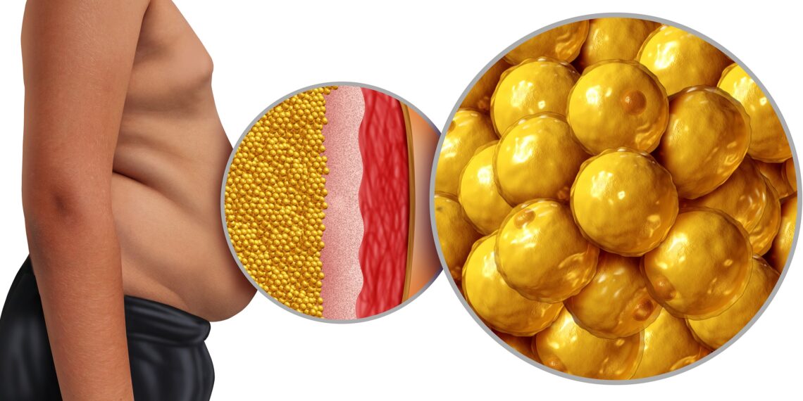 Ernährung: Diese Diät reduziert viszerales Bauchfett am effektivsten ...