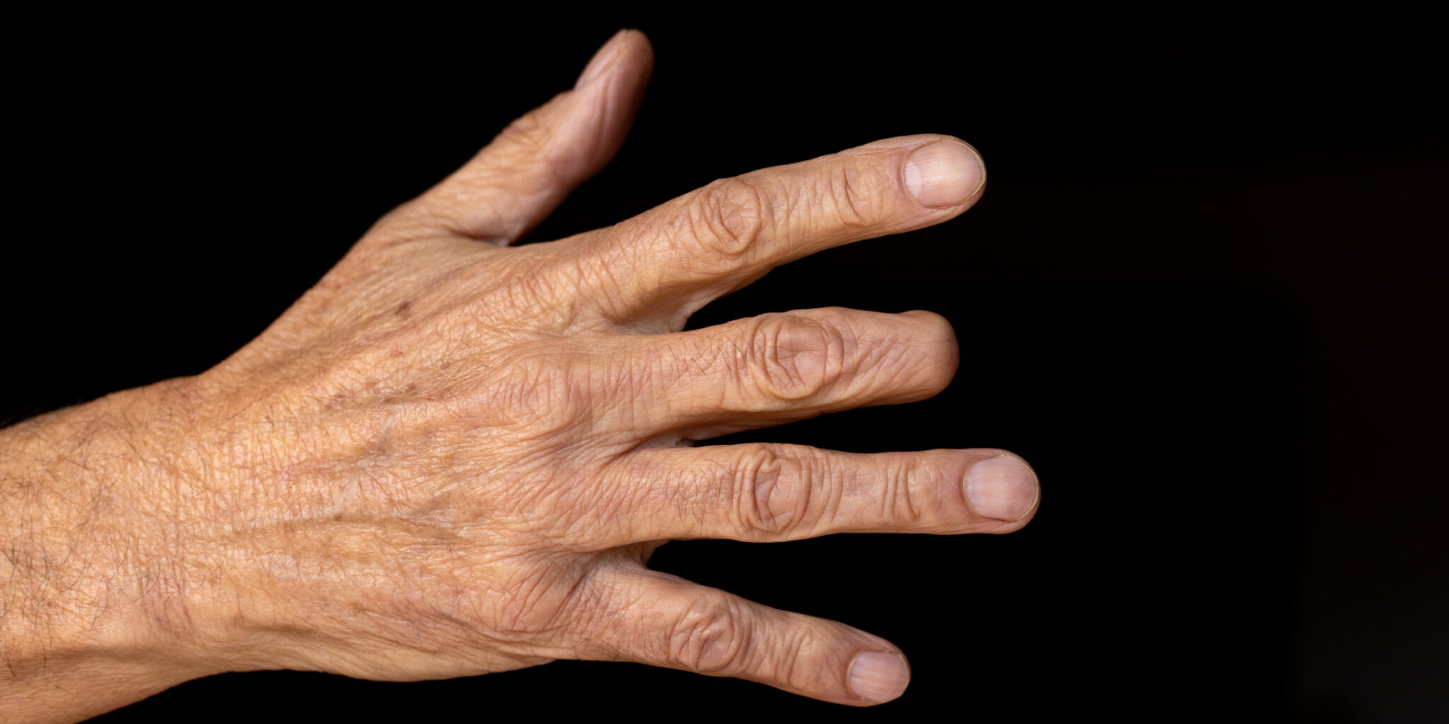 Phantomschmerzen – Ursachen, Symptome und Therapien – Heilpraxis