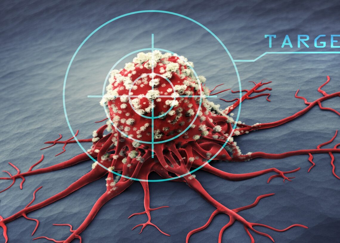 Lippenkrebs – Ursachen, Symptome und Behandlung – Heilpraxis