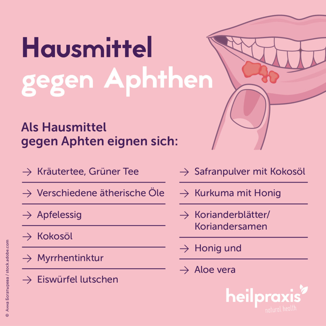 Hausmittel gegen Aphthen – Heilpraxis